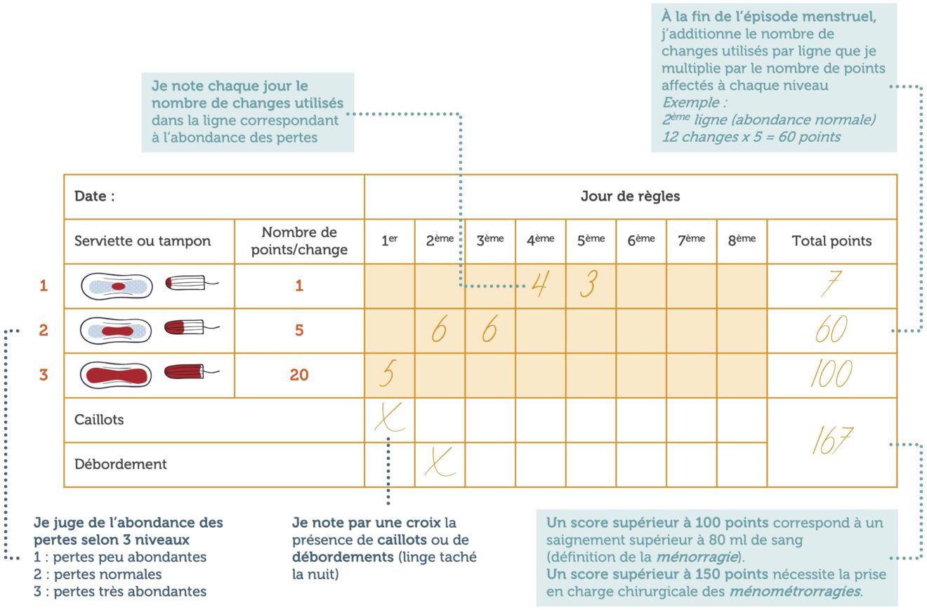 Hémophilie | Repérer les symptômes chez la femme